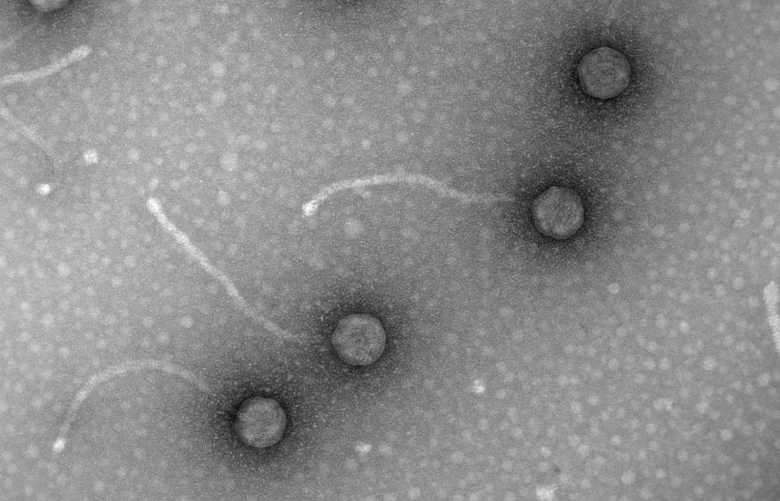 Fagos: ¿cómo actúan los virus "come" bacterias?